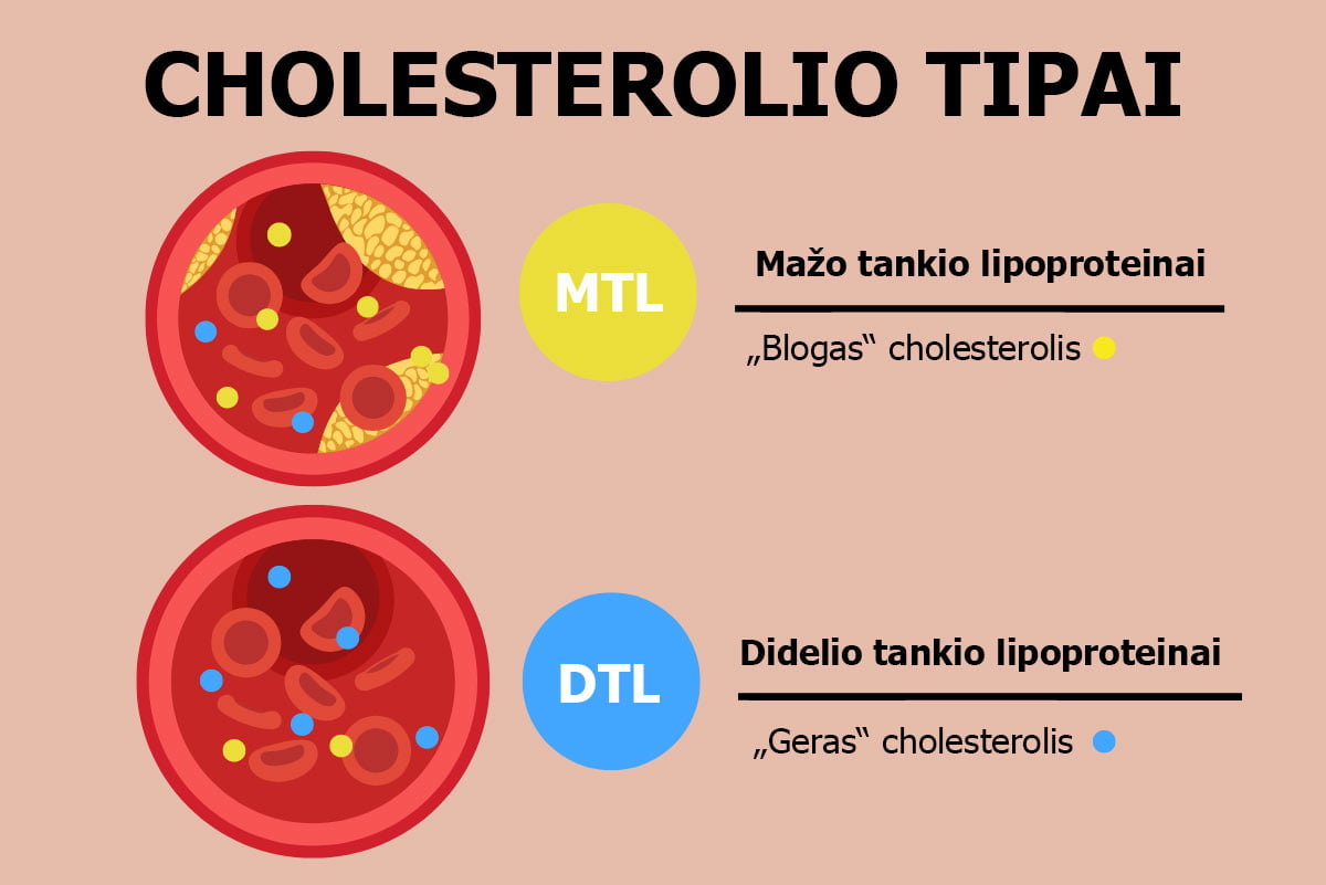 Kaip sumažinti cholesterolį kraujyje be vaistų? - OHOHO.LT